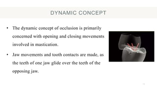 Occlusal schemes in CD_Dr Shuchi Jain.pptx
