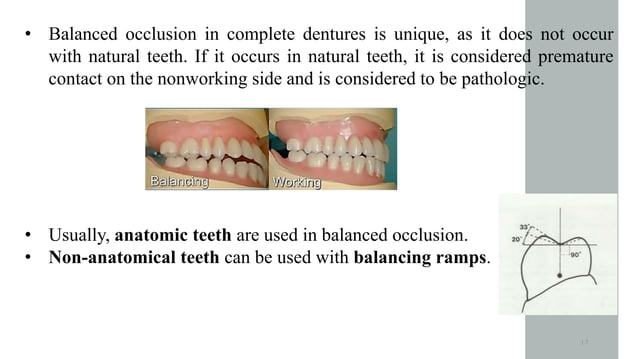 Occlusal schemes in CD_Dr Shuchi Jain.pptx | Dental Health | Diseases ...