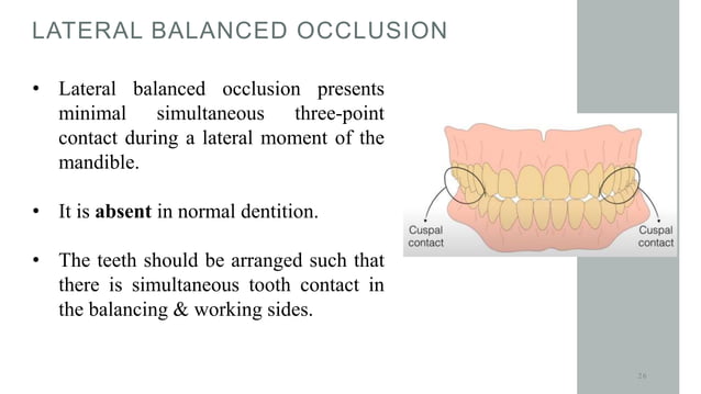 Occlusal schemes in CD_Dr Shuchi Jain.pptx | Dental Health | Diseases ...