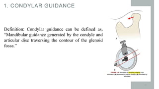 Occlusal schemes in CD_Dr Shuchi Jain.pptx