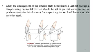 Occlusal schemes in CD_Dr Shuchi Jain.pptx