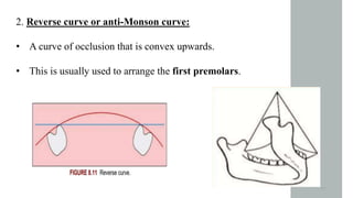 Occlusal schemes in CD_Dr Shuchi Jain.pptx