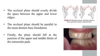Occlusal schemes in CD_Dr Shuchi Jain.pptx