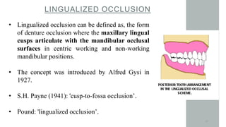 Occlusal schemes in CD_Dr Shuchi Jain.pptx