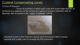 Occlusal schemes in complete denture | PPTX