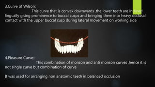 Occlusal schemes in complete denture | PPTX
