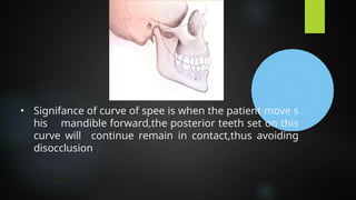 occlusal schemes in complete denture (1).pptx