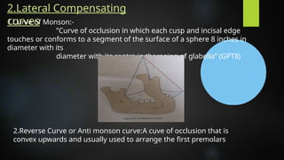 occlusal schemes in complete denture (1).pptx