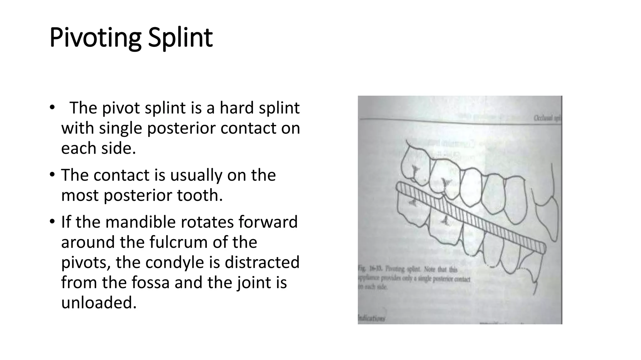 Occlusal splints | PPTX