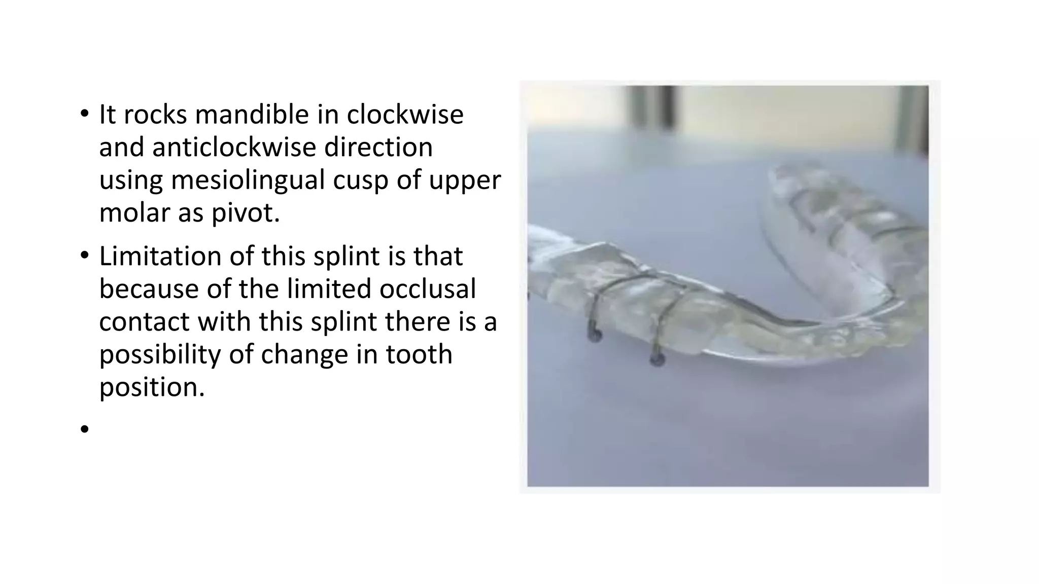 Occlusal splints | PPTX