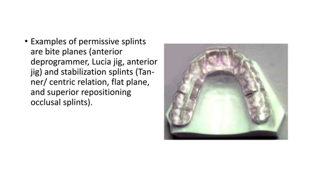Occlusal splints | PPTX | Physical Therapy | Wellness