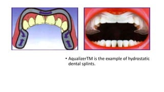 Occlusal splints | PPTX