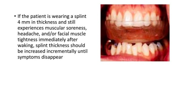 Occlusal splints | PPTX | Physical Therapy | Wellness