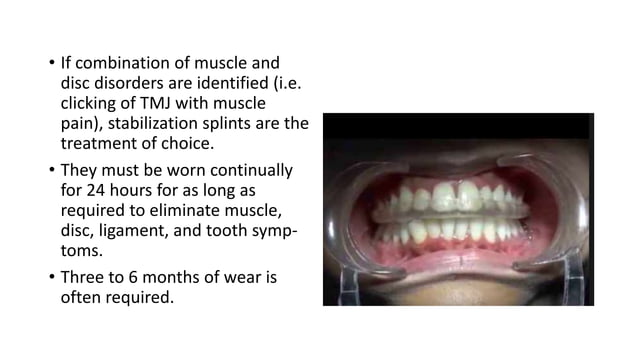 Occlusal splints | PPTX | Physical Therapy | Wellness