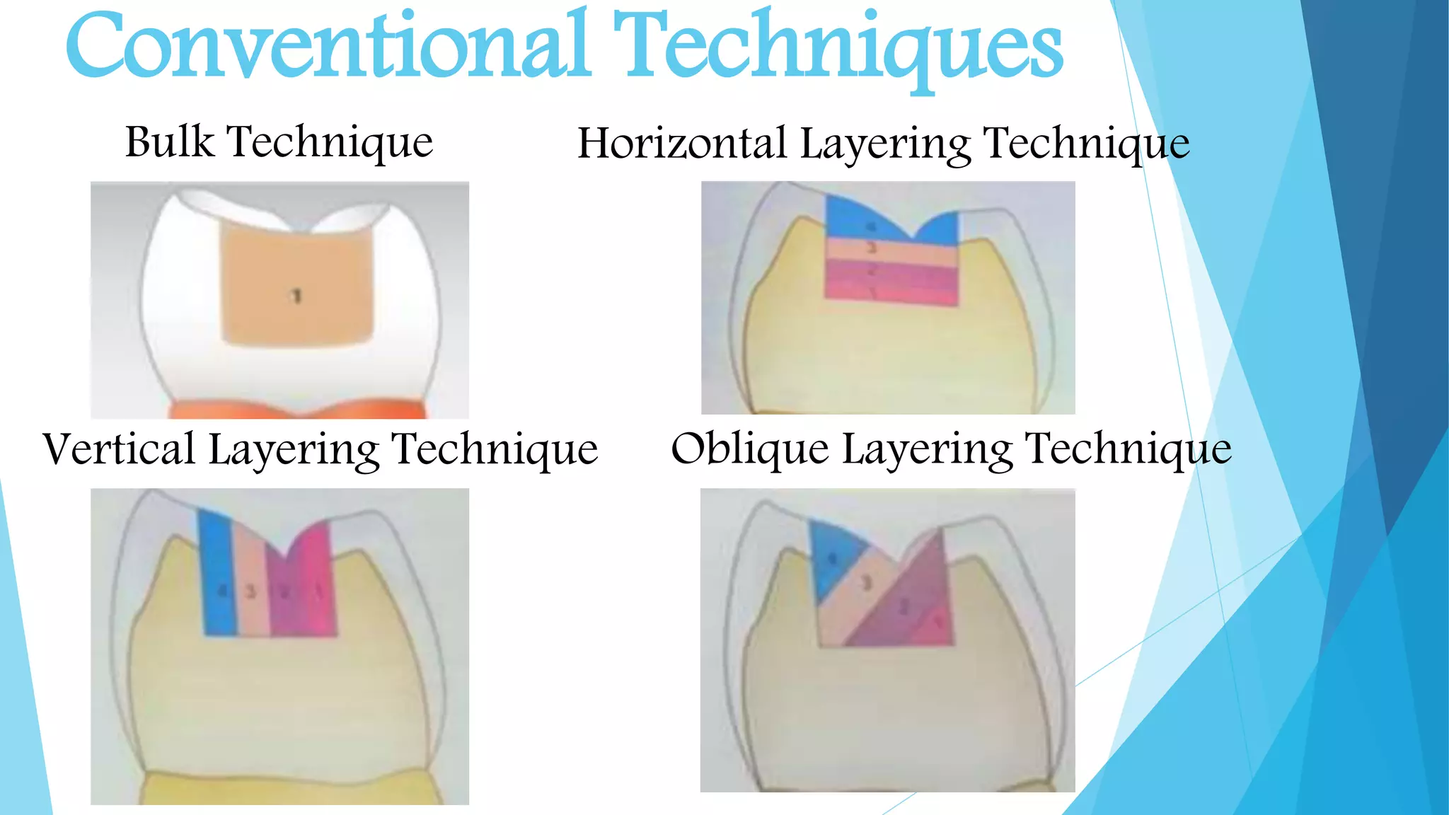 Occlusal stamp technique | PPTX