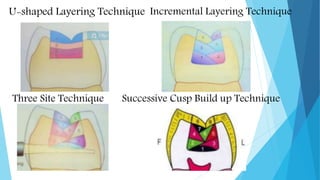 Occlusal stamp technique | PPTX