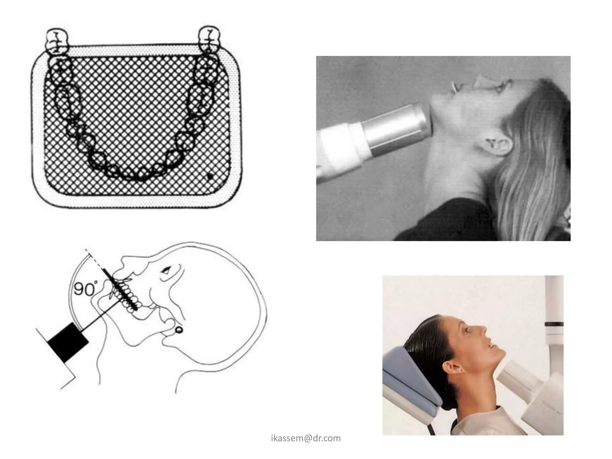 Occlusal techniques | PDF