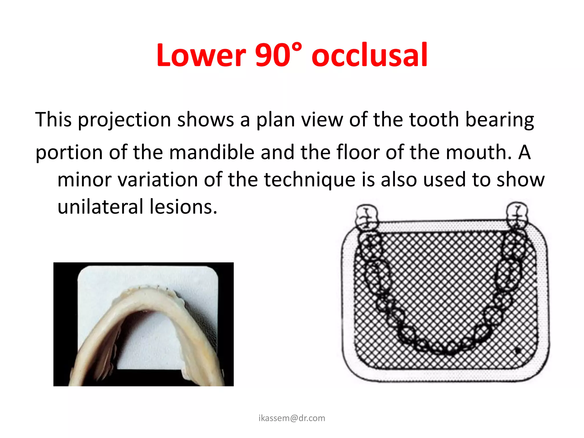 Occlusal techniques | PDF