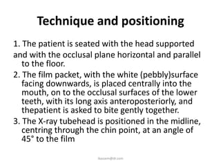 Occlusal techniques | PDF