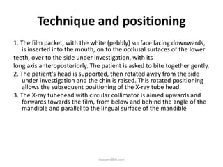 Occlusal techniques | PDF