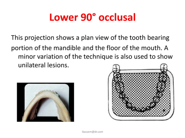 Occlusal techniques | PDF | Dental Health | Diseases and Conditions