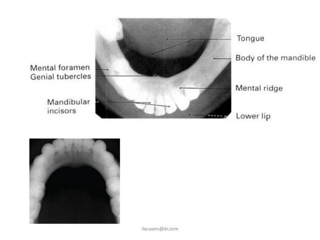 Occlusal techniques