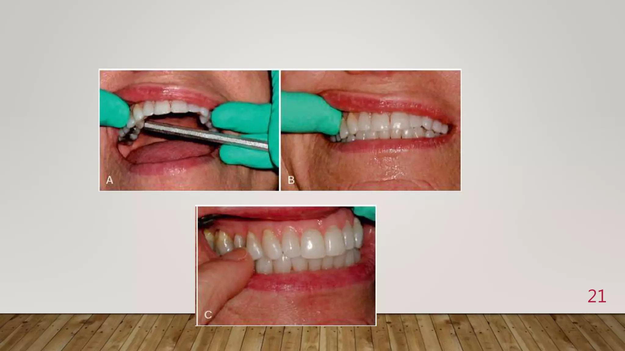 Occlusal evaluation and therapy | PPTX