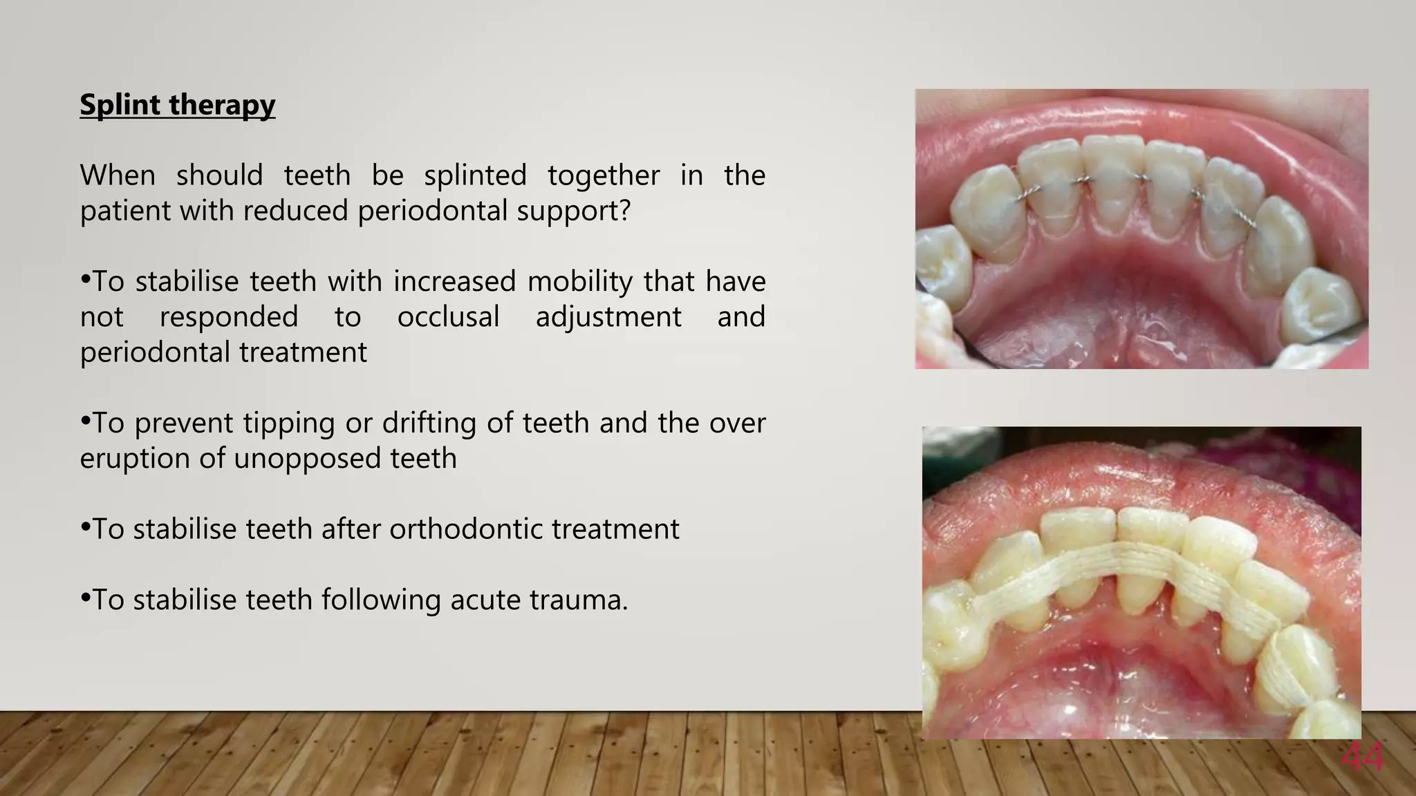 Occlusal evaluation and therapy | PPTX