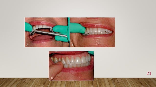 Occlusal evaluation and therapy | PPTX | Dental Health | Diseases and ...