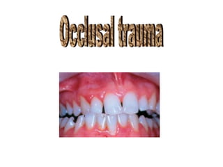 Occlusal trauma | PPT