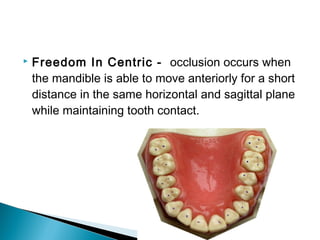 Occlusion | PPT