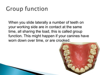 Occlusion | PPT