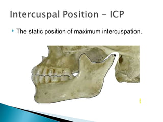 Occlusion | PPT