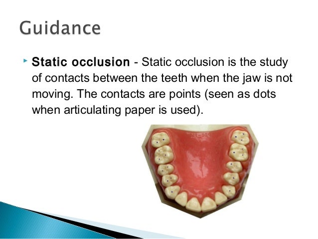 Occlusion