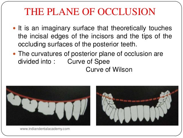 Occlusion