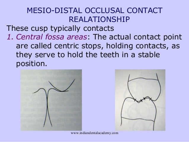 Occlusion