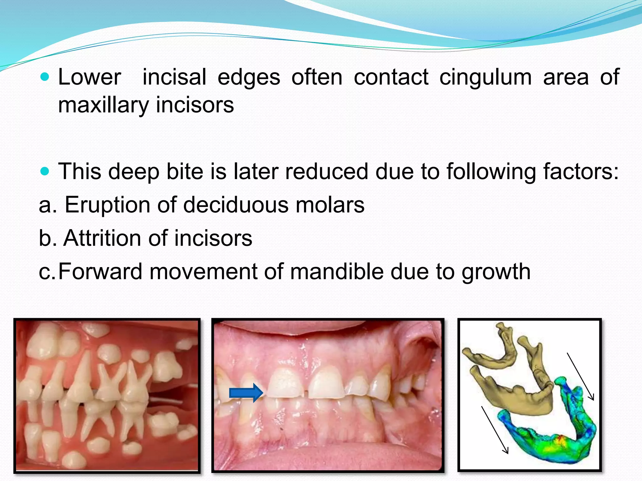 Development of Occlusion | PPTX