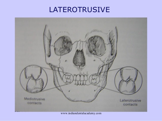 Occlusion./ orthodontic continuing education