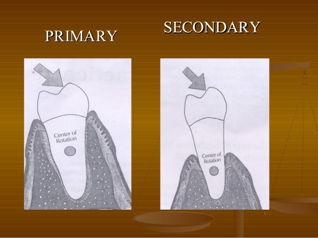 Occlusion in Periodontics