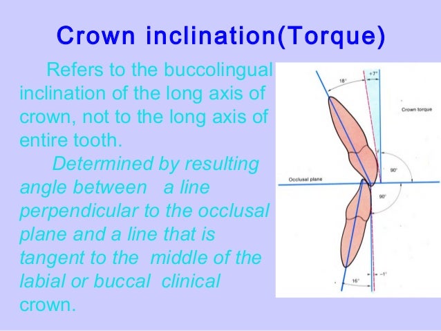 Occlusion