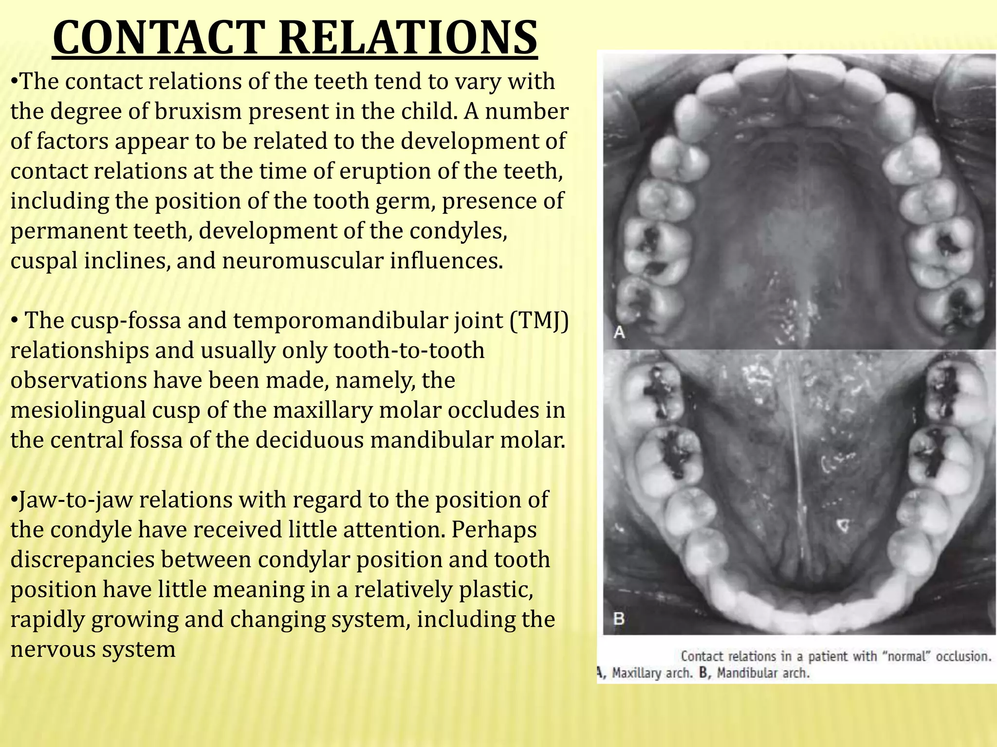 Occlusion | PPTX