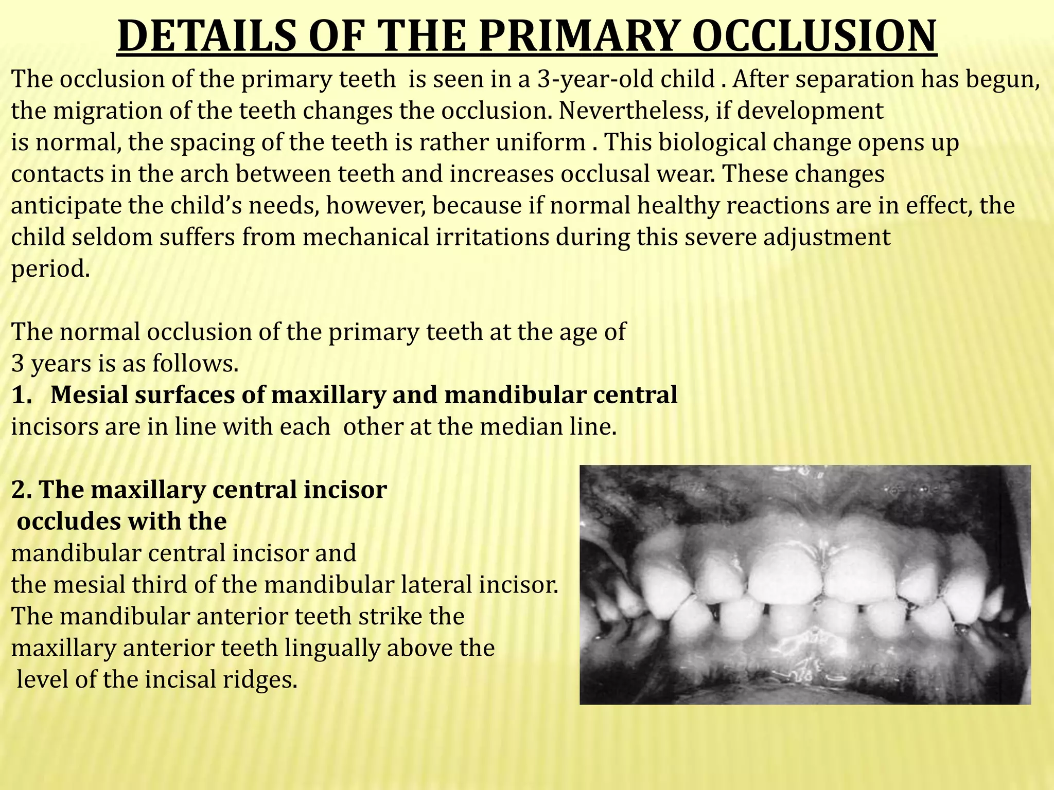 Occlusion | PPTX