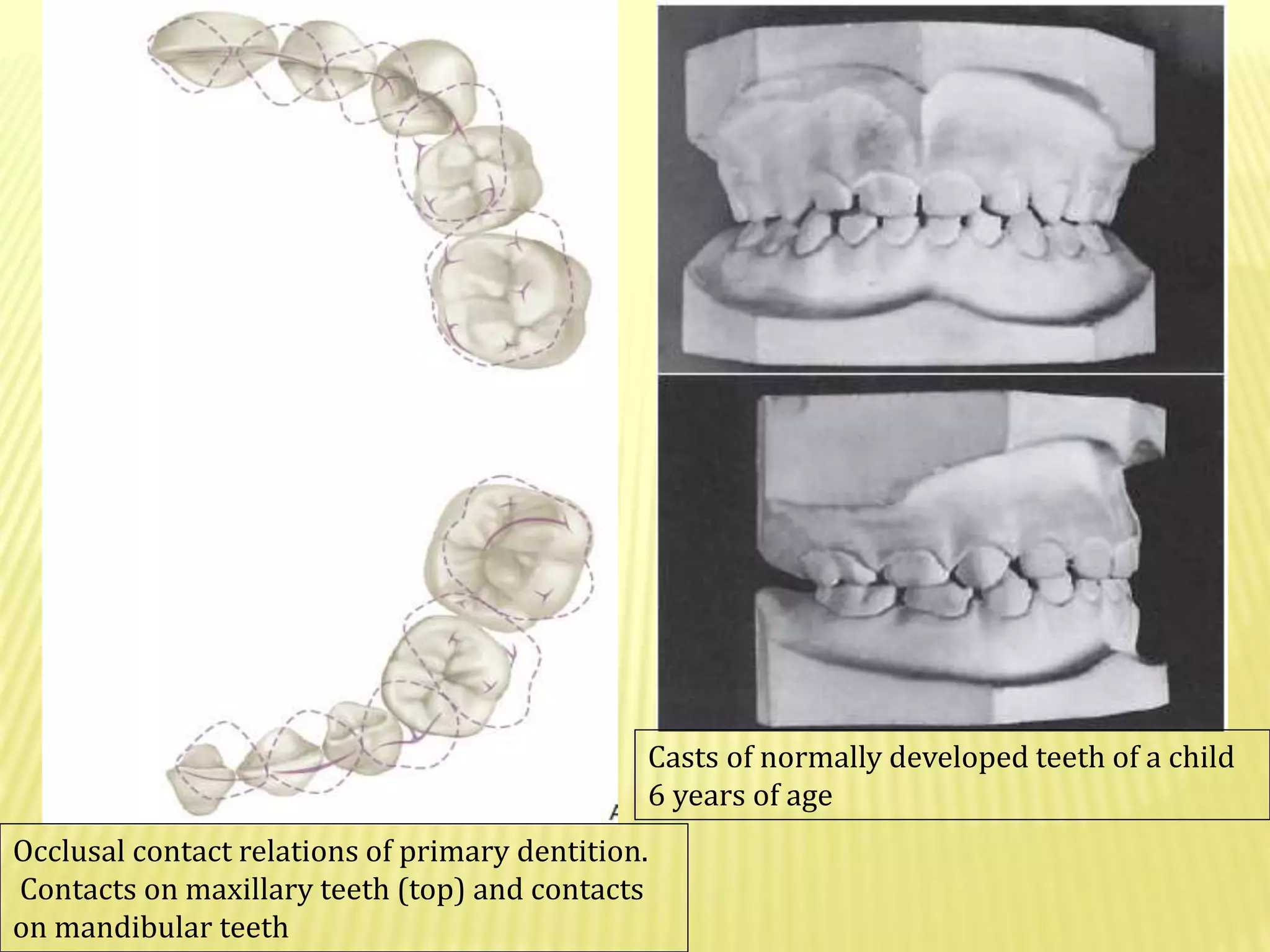 Occlusion | PPTX