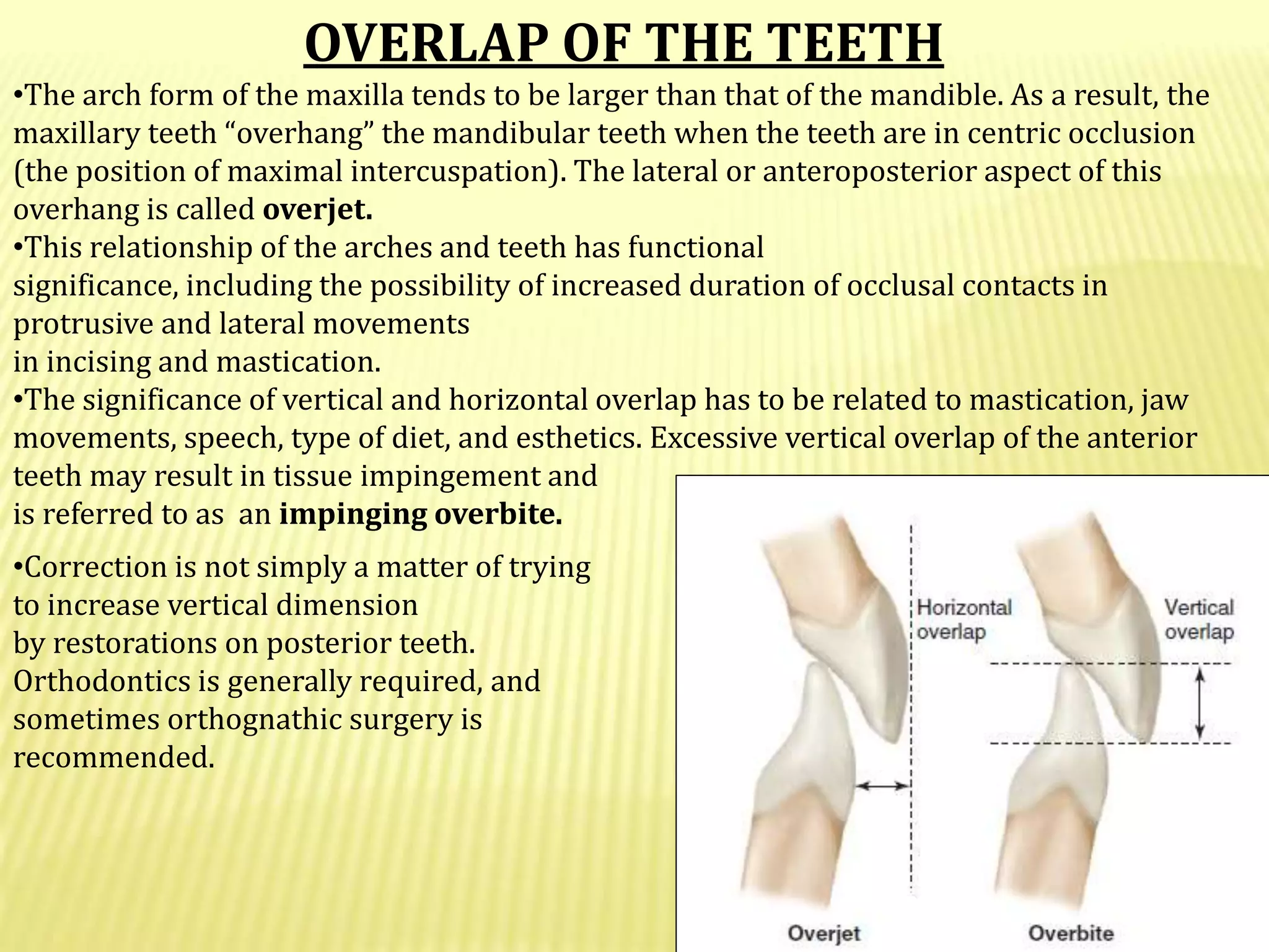 Occlusion | PPTX