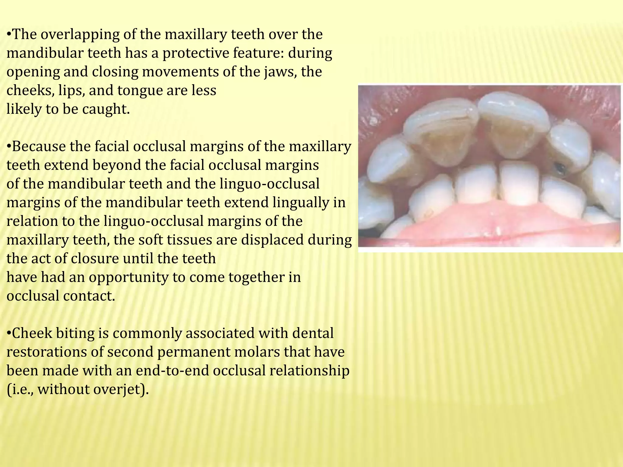 Occlusion | PPTX