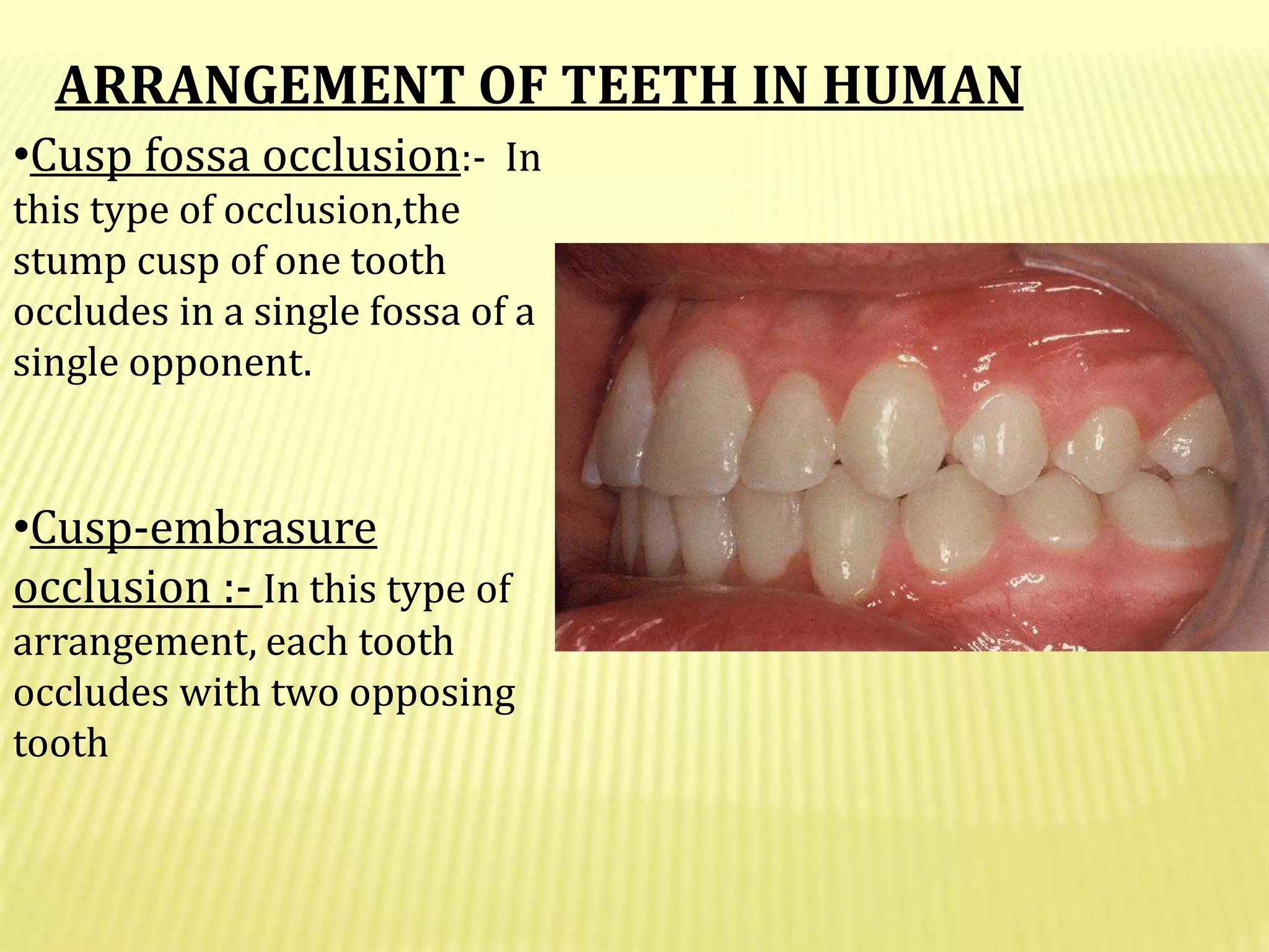 Occlusion | PPTX