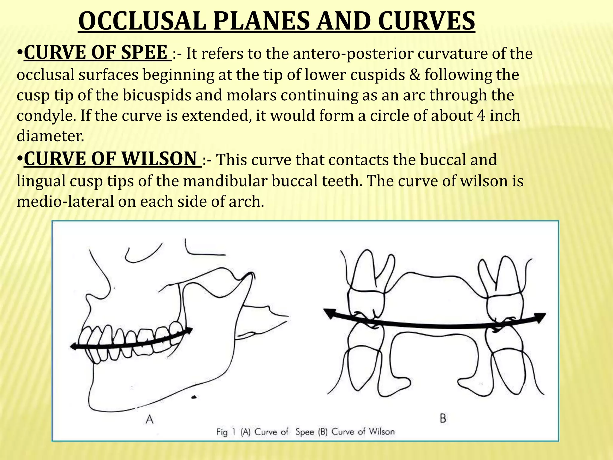 Occlusion | PPTX