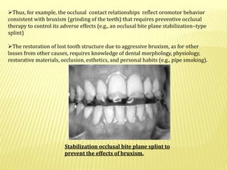 Occlusion | PPTX
