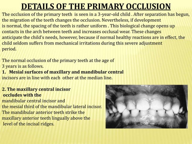 Occlusion | PPTX