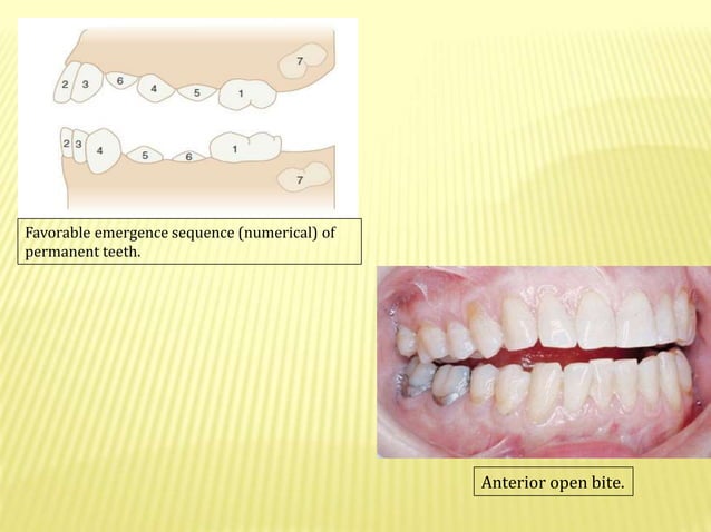 Occlusion | PPTX